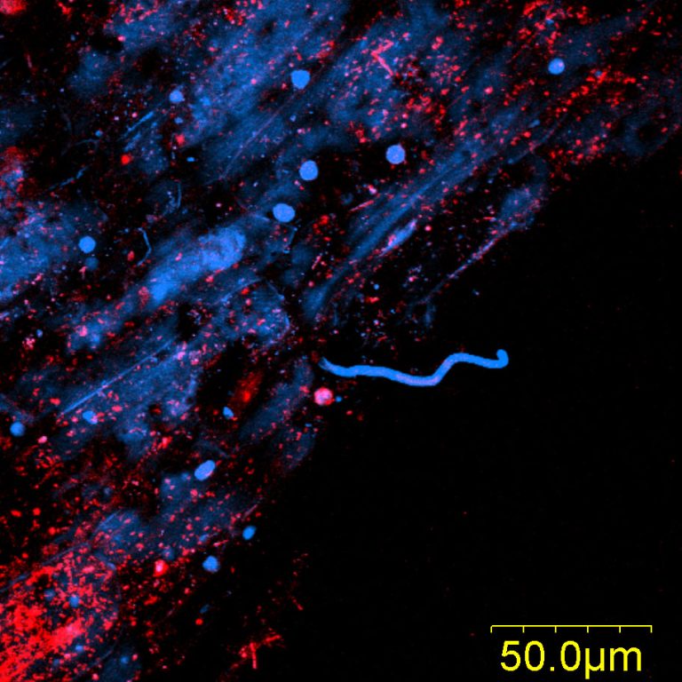 כימיה של הקרקע, הזנת הצמח ומיקרוביולוגיה Archives - Volcani Website